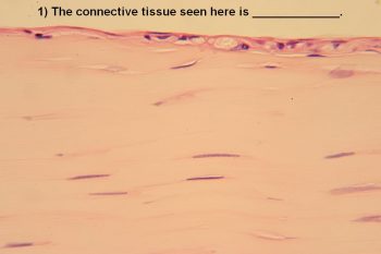 Quiz – Connective Tissues – Histology Atlas for Anatomy and Physiology