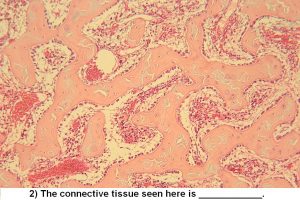 Quiz – Connective Tissues – Histology Atlas for Anatomy and Physiology