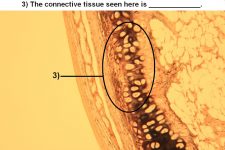 Quiz – Connective Tissues – Histology Atlas for Anatomy and Physiology