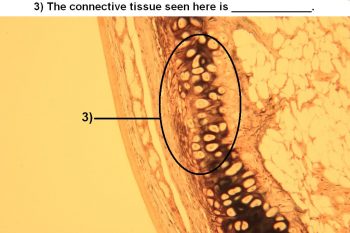 Quiz – Connective Tissues – Histology Atlas for Anatomy and Physiology