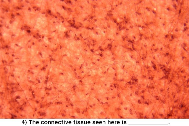 Quiz – Connective Tissues – Histology Atlas for Anatomy and Physiology