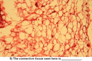 Quiz – Connective Tissues – Histology Atlas for Anatomy and Physiology