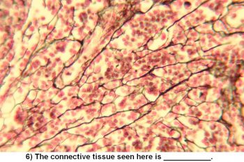 Quiz – Connective Tissues – Histology Atlas for Anatomy and Physiology