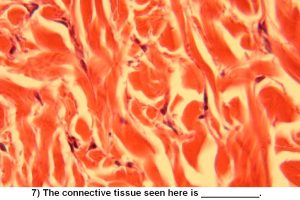Quiz – Connective Tissues – Histology Atlas for Anatomy and Physiology
