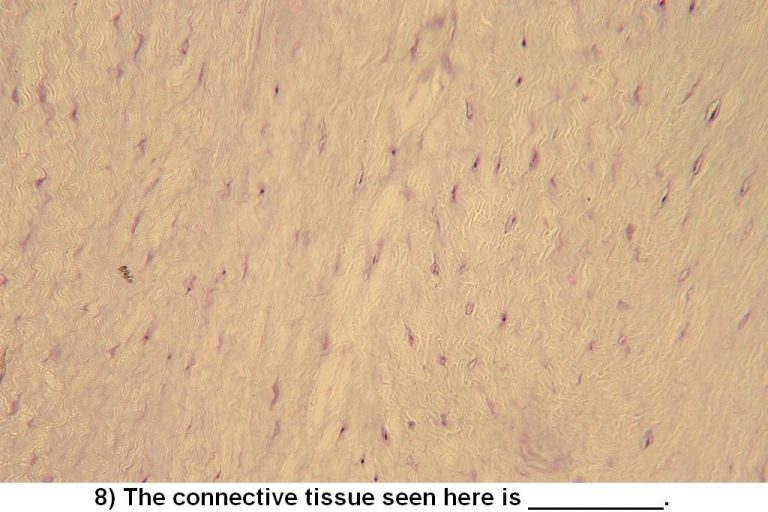 Quiz – Connective Tissues – Histology Atlas for Anatomy and Physiology