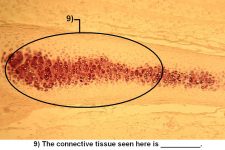 Quiz – Connective Tissues – Histology Atlas for Anatomy and Physiology