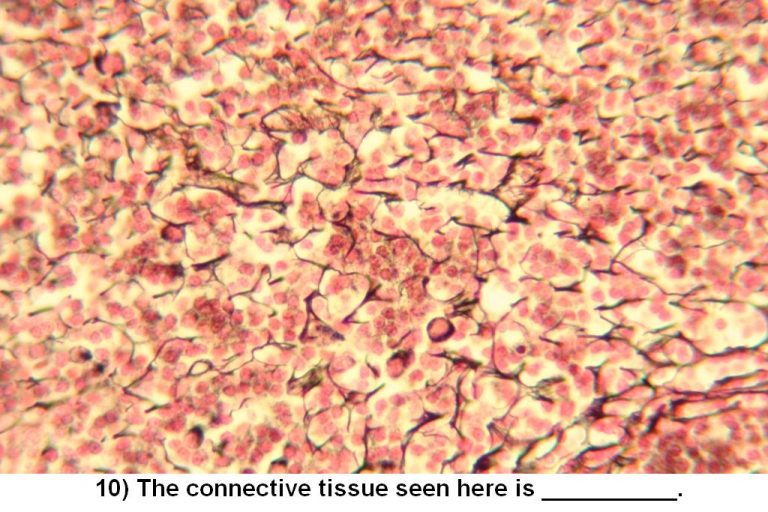 Quiz – Connective Tissues – Histology Atlas for Anatomy and Physiology