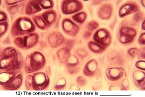 Quiz – Connective Tissues – Histology Atlas for Anatomy and Physiology