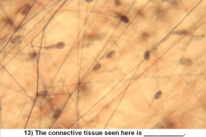 Quiz – Connective Tissues – Histology Atlas for Anatomy and Physiology