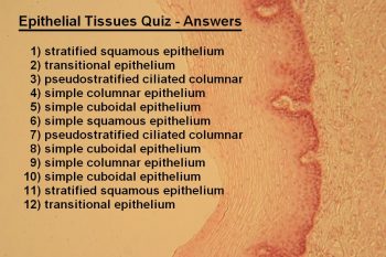 Quiz – Epithelial Tissues – Histology Atlas for Anatomy and Physiology