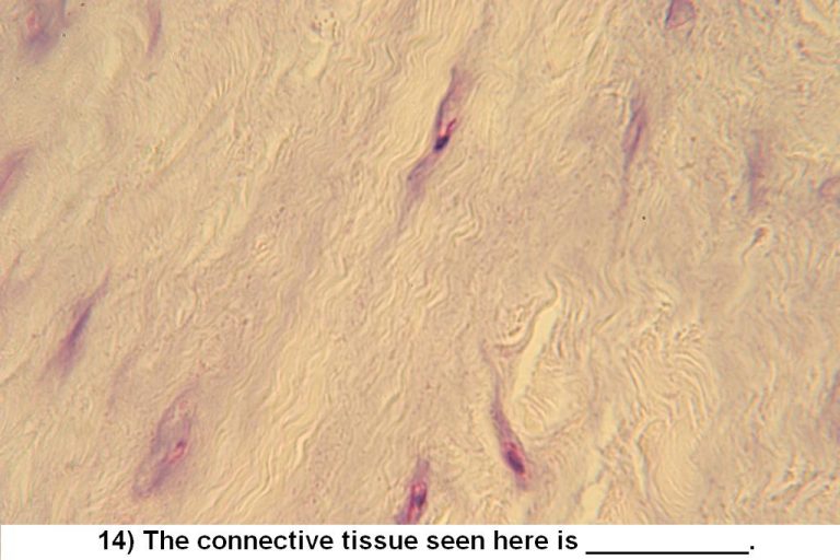 Quiz – Connective Tissues – Histology Atlas for Anatomy and Physiology