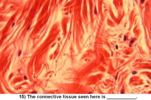 Quiz – Connective Tissues – Histology Atlas for Anatomy and Physiology