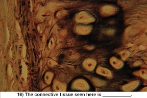 Quiz – Connective Tissues – Histology Atlas for Anatomy and Physiology