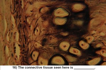 Quiz – Connective Tissues – Histology Atlas for Anatomy and Physiology