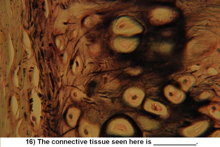 Quiz – Connective Tissues – Histology Atlas for Anatomy and Physiology