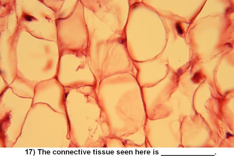 Quiz – Connective Tissues – Histology Atlas for Anatomy and Physiology