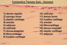Quiz – Connective Tissues – Histology Atlas for Anatomy and Physiology