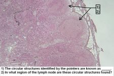 Quiz – Lymphatic System – Histology Atlas for Anatomy and Physiology