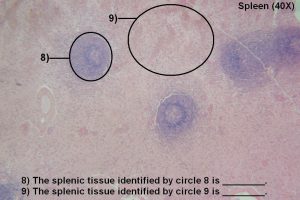 Quiz – Lymphatic System – Histology Atlas for Anatomy and Physiology
