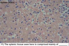 Quiz – Lymphatic System – Histology Atlas for Anatomy and Physiology