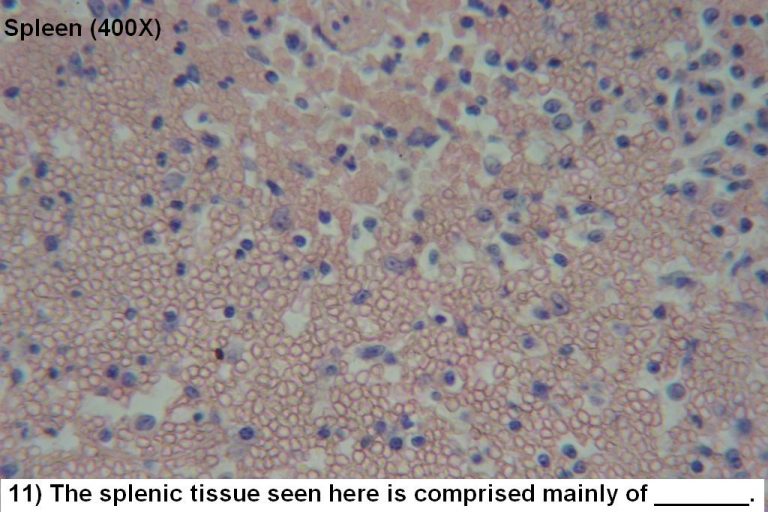 Quiz – Lymphatic System – Histology Atlas for Anatomy and Physiology